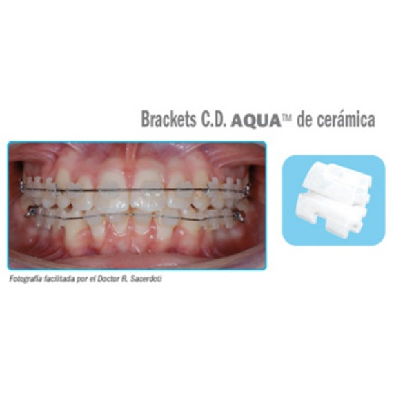 Brackets | Tirden | Acercándote a la vanguardia médica y dental
